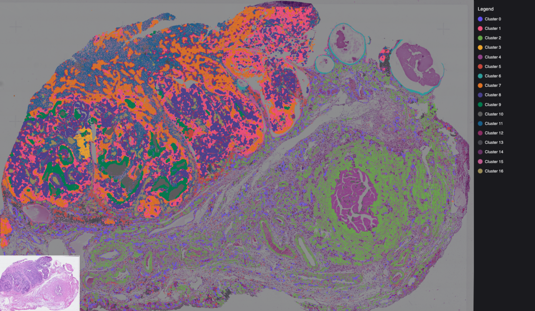 Spatial Cell Type Domain Detection - BioTuring